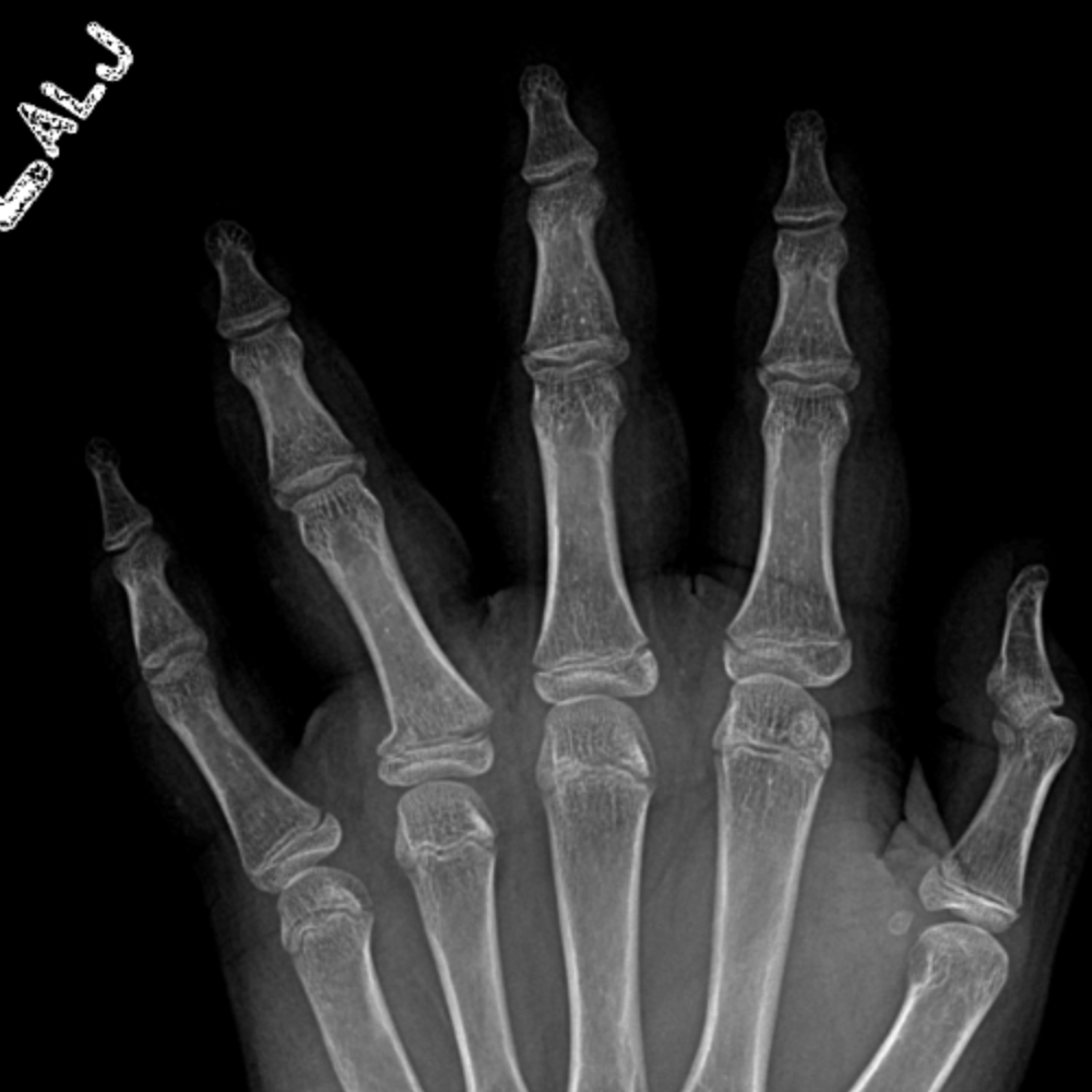 Case #29 - CaseStacks.com