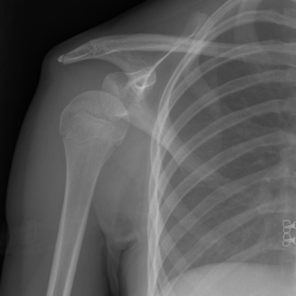 Case #29 - CaseStacks.com