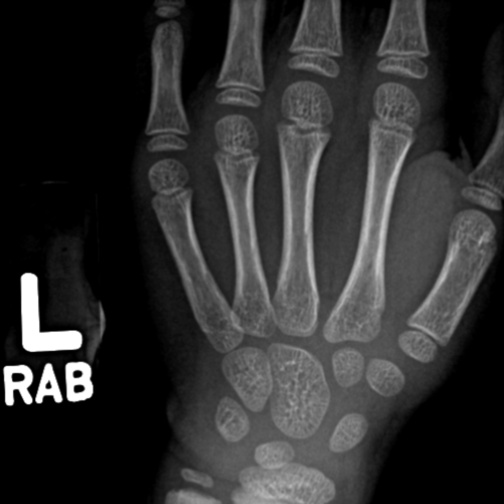 Case #3 - CaseStacks.com