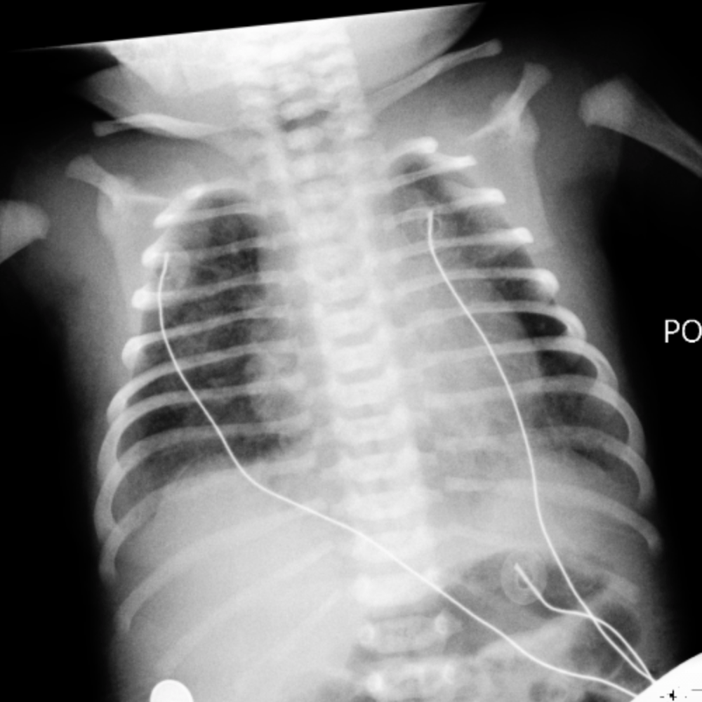 Case #3 - CaseStacks.com