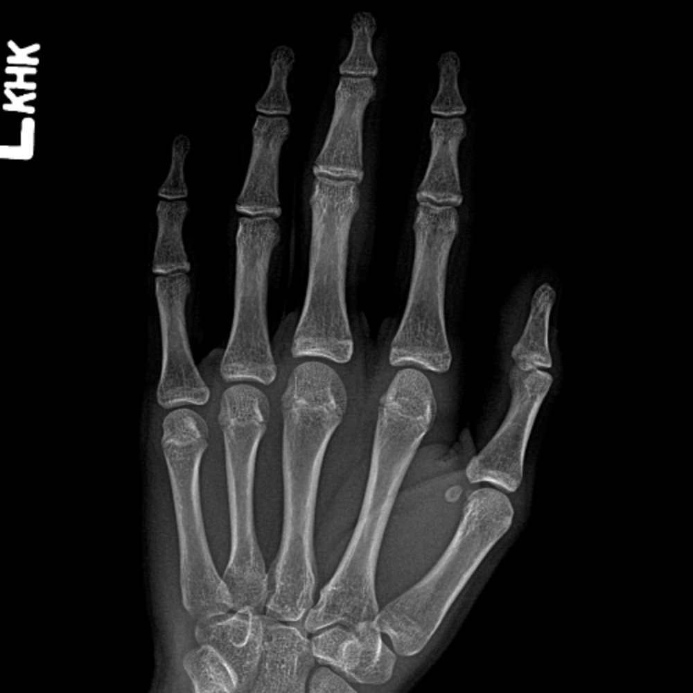 Case #8 - CaseStacks.com