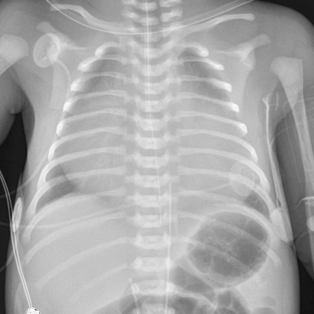 Case #4 - CaseStacks.com