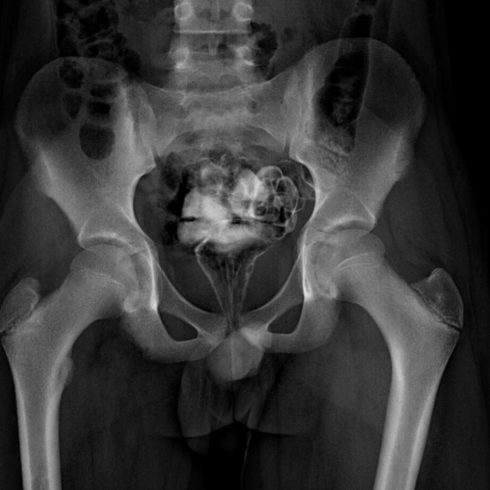 Case #4 - CaseStacks.com