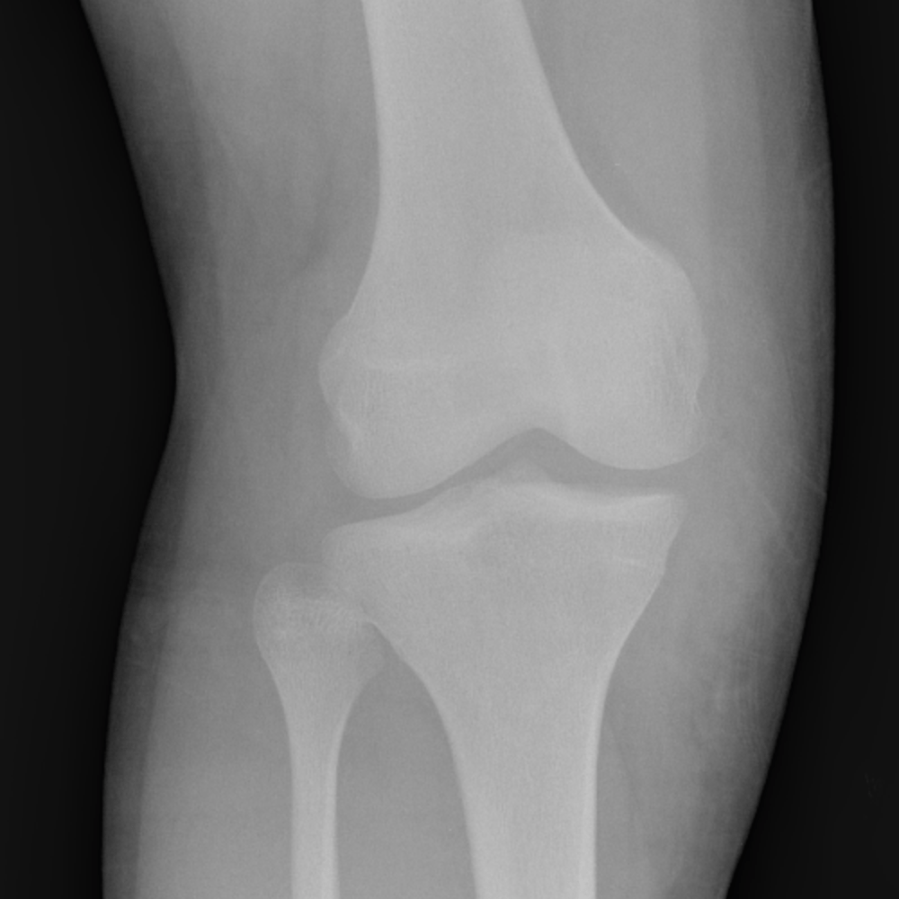 Case #4 - CaseStacks.com