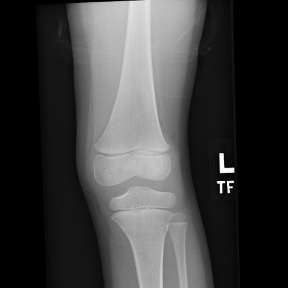 Case #4 - CaseStacks.com