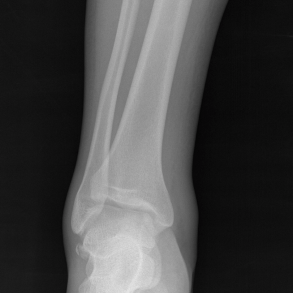 Case #4 - CaseStacks.com