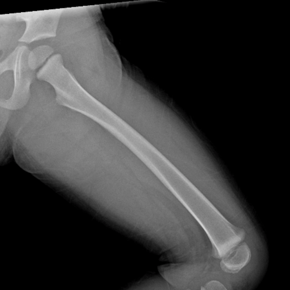 Case #4 - CaseStacks.com