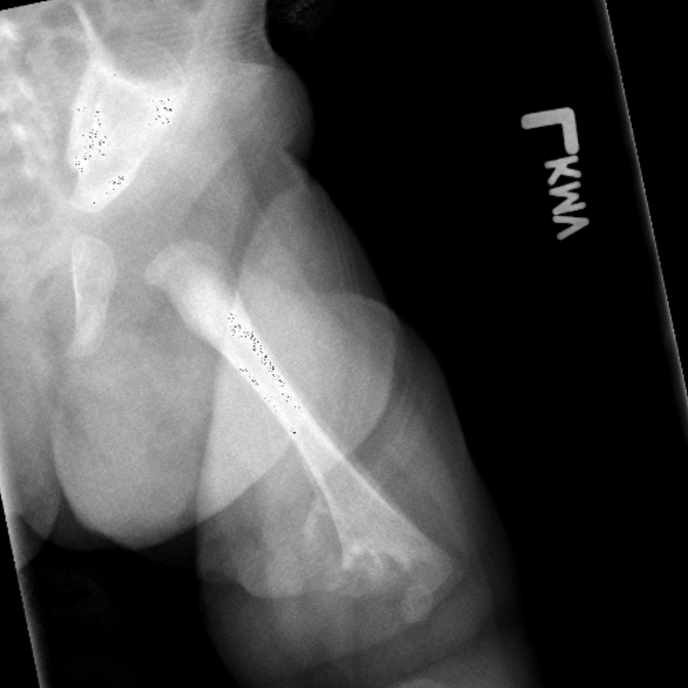 Case #4 - CaseStacks.com