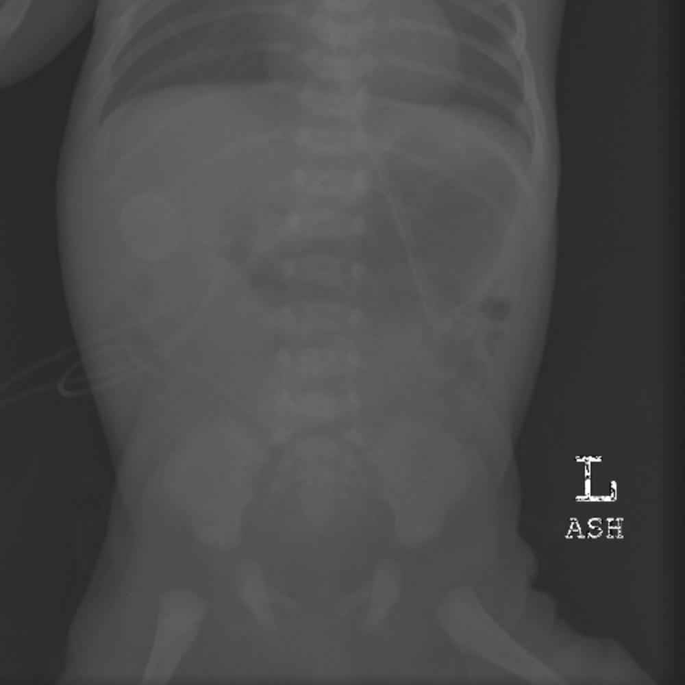 Case #5 - CaseStacks.com