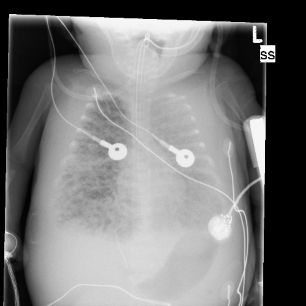 Case #5 - CaseStacks.com