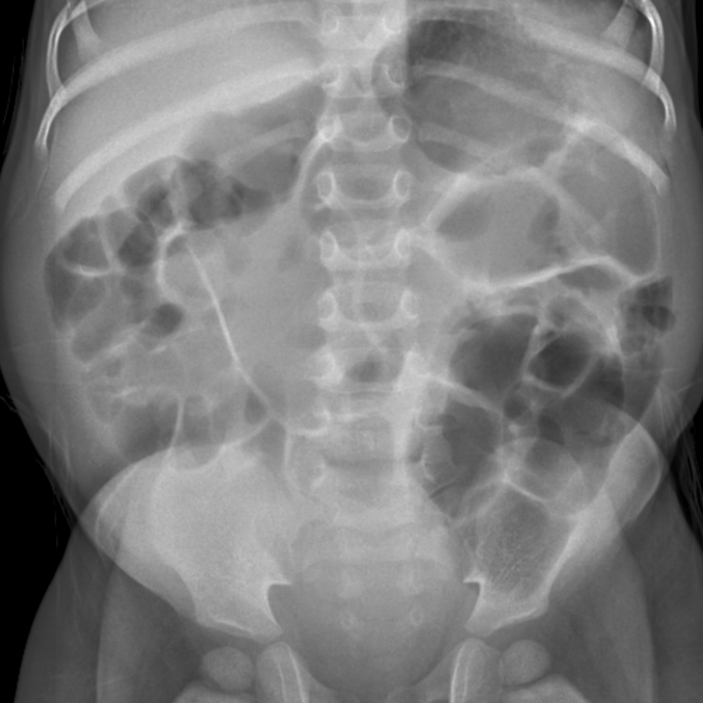 Case #6 - CaseStacks.com