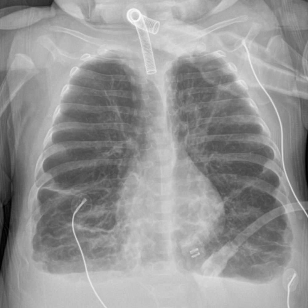 Case #6 - CaseStacks.com