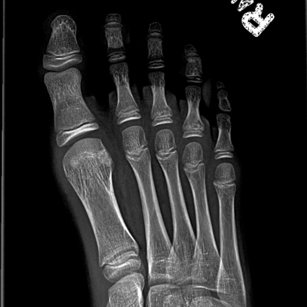 Case #6 - CaseStacks.com