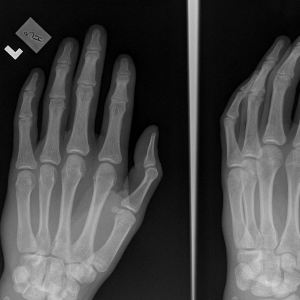 Case #6 - CaseStacks.com