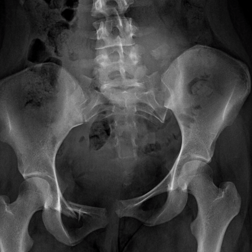 Case #7 - CaseStacks.com