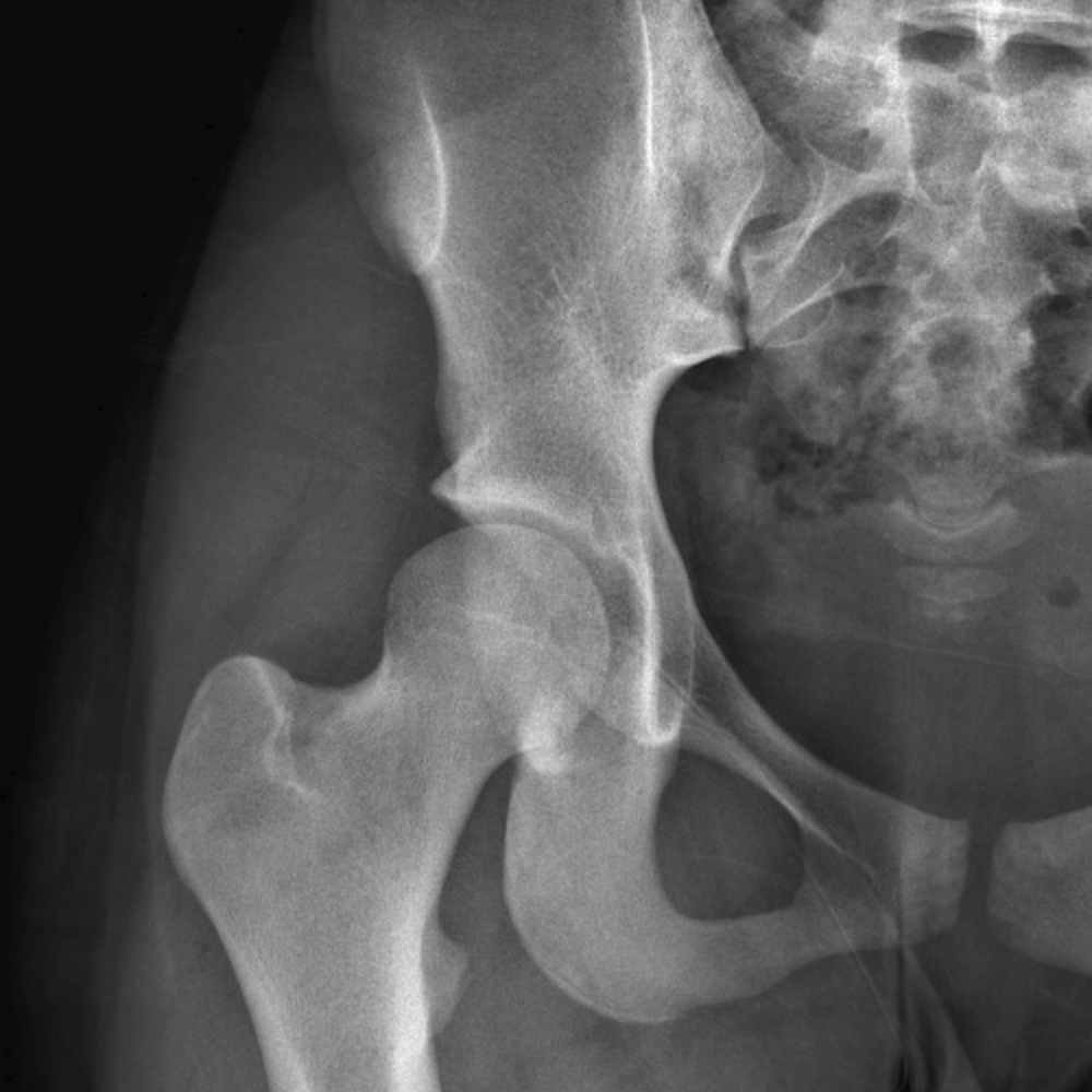 CaseStacks.com - Radiology Case Case #8