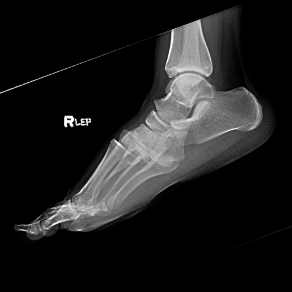 Case #8 - CaseStacks.com