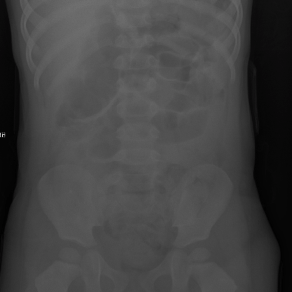 Case #8 - CaseStacks.com