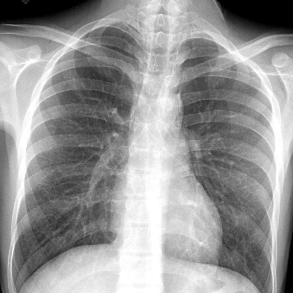 CaseStacks.com - Peds Radiographs Case #8