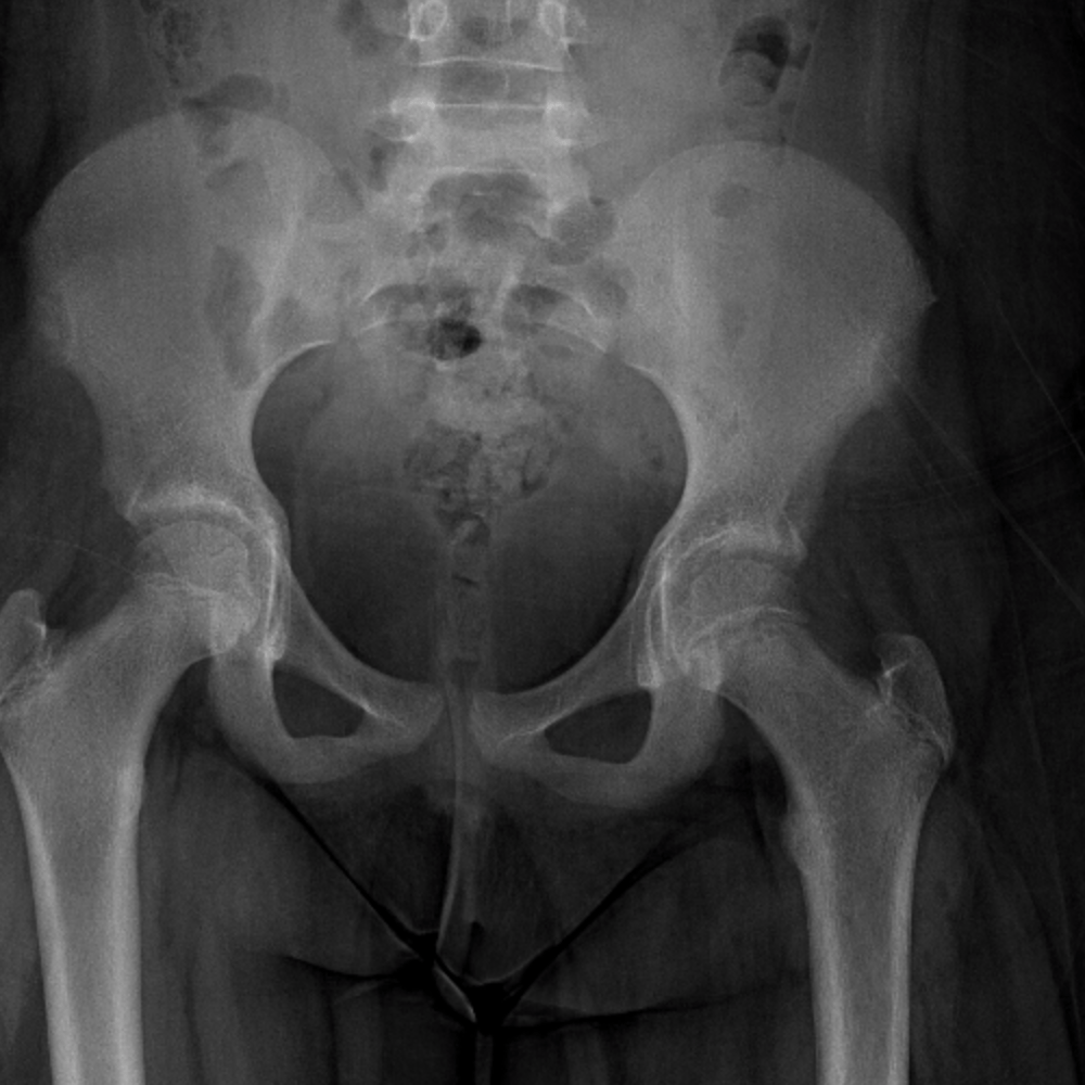 Case #9 - CaseStacks.com