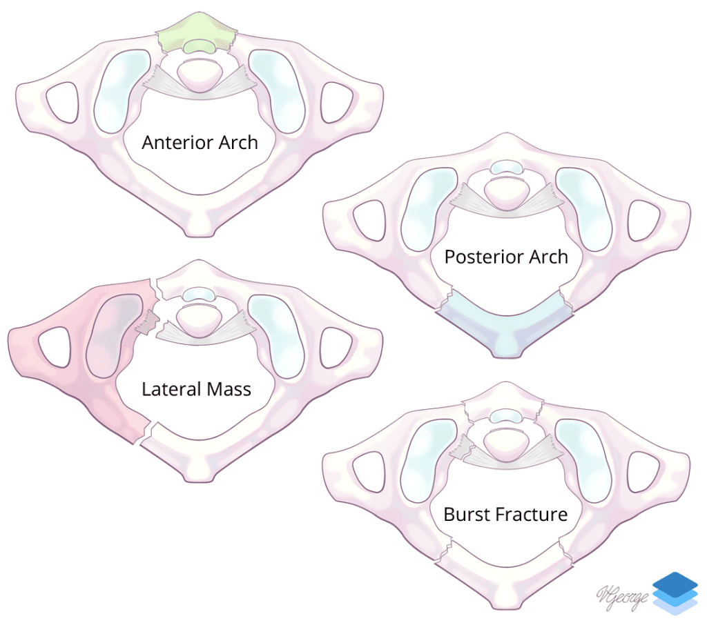 CaseStacks.com - Neuroradiology CT Illustrations, Diagrams, and Videos