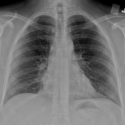 Case #1 - CaseStacks.com