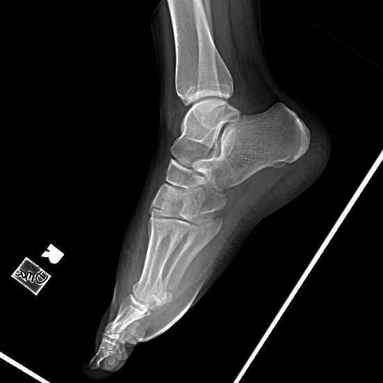 Case #15 - CaseStacks.com