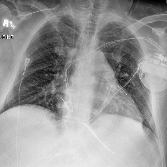 Case #12 - CaseStacks.com