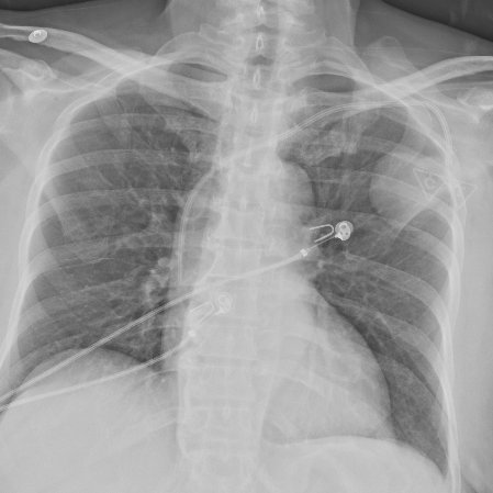 Case #10 - CaseStacks.com