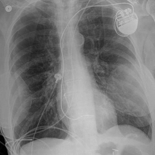 Case #7 - CaseStacks.com