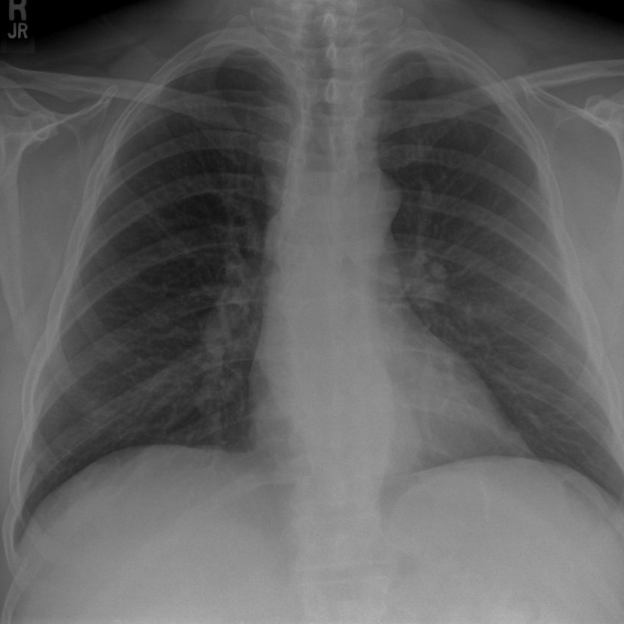 Case #41 - CaseStacks.com