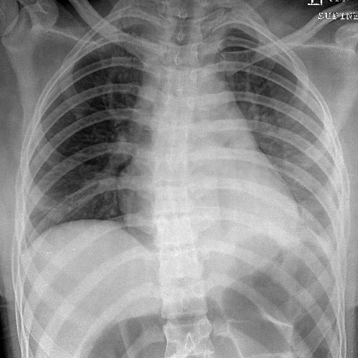 Case #6 - CaseStacks.com