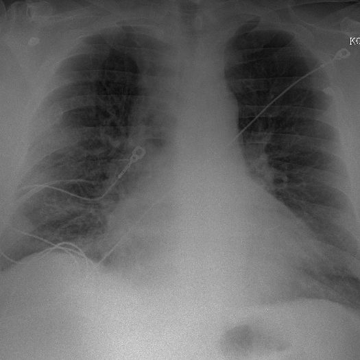 Case #12 - CaseStacks.com