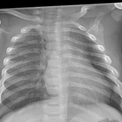 Case #12 - CaseStacks.com