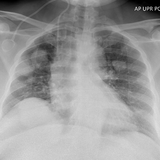 Case #18 - CaseStacks.com