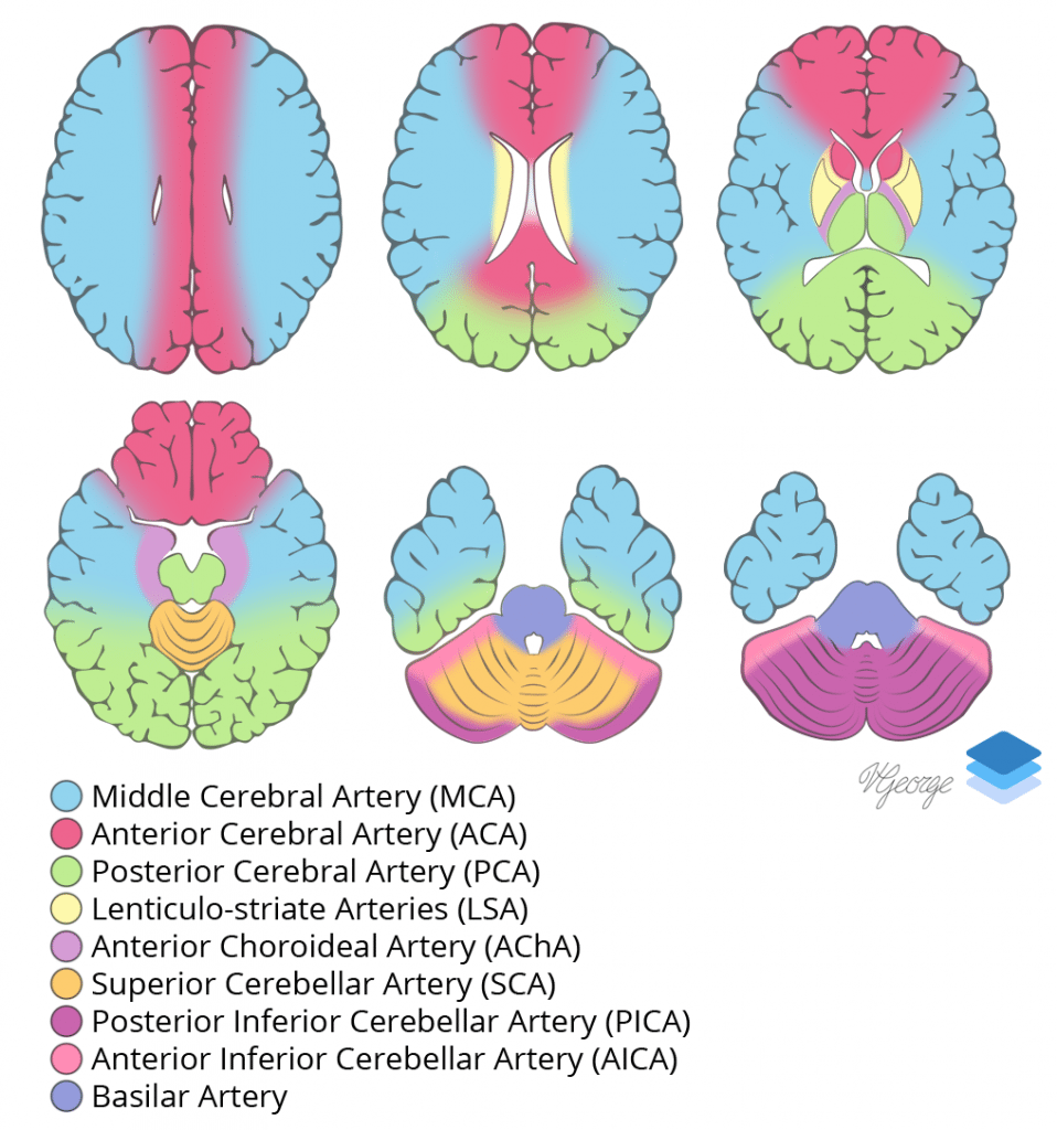 CaseStacks.com - Neuroradiology CT Illustrations, Diagrams, and Videos