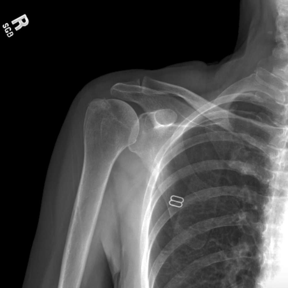 Case #5 - CaseStacks.com