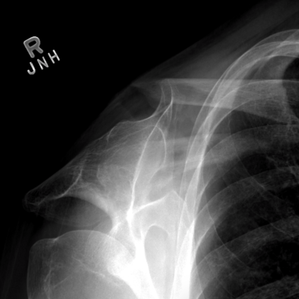 Case #8 - CaseStacks.com