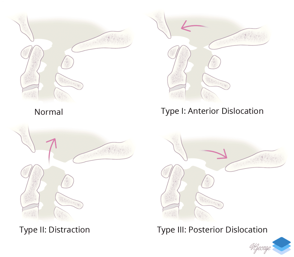 CaseStacks.com - Neuroradiology CT Illustrations, Diagrams, and Videos