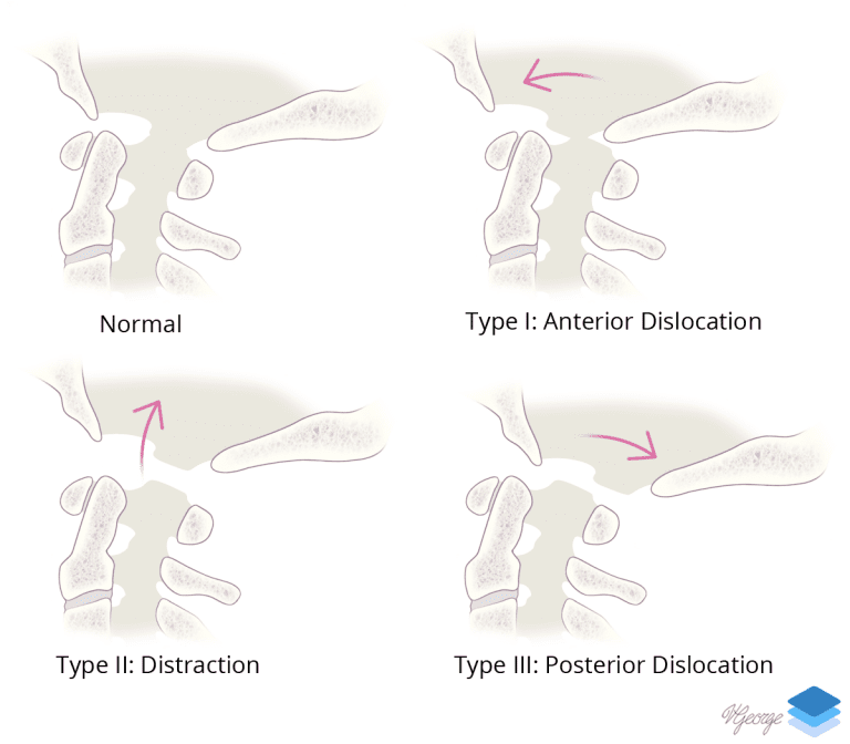 CaseStacks.com - Neuroradiology CT Illustrations, Diagrams, and Videos