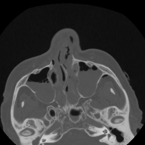 Case #14 - CaseStacks.com