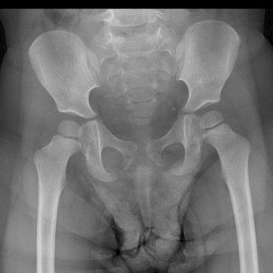 Case #12 - CaseStacks.com