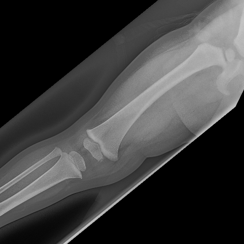 Case #19 - CaseStacks.com