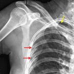 Case #29 - CaseStacks.com