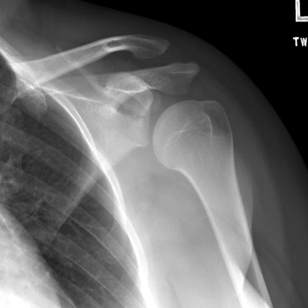 Case #10 - CaseStacks.com