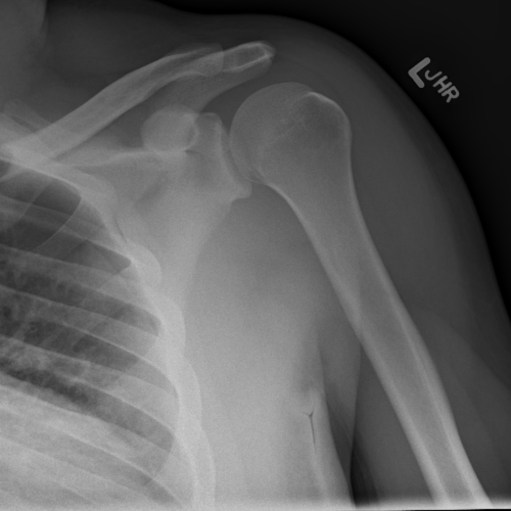 CaseStacks.com - MSK Radiograph Case #11