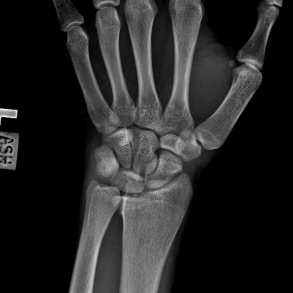 CaseStacks.com - MSK Radiograph Case #11