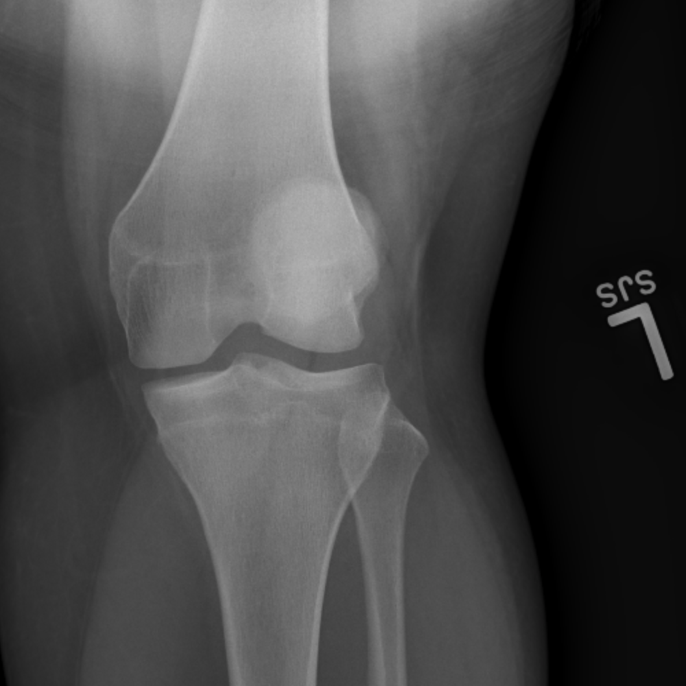 Case #11 - CaseStacks.com