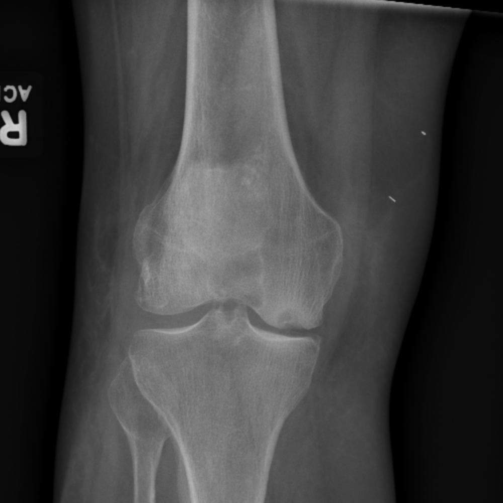 Case #12 - CaseStacks.com