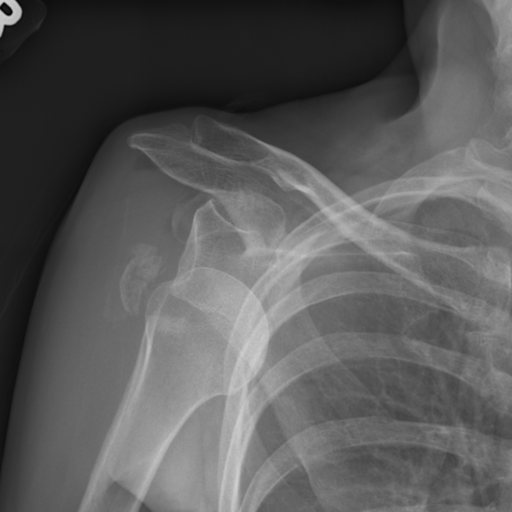 Case #12 - CaseStacks.com